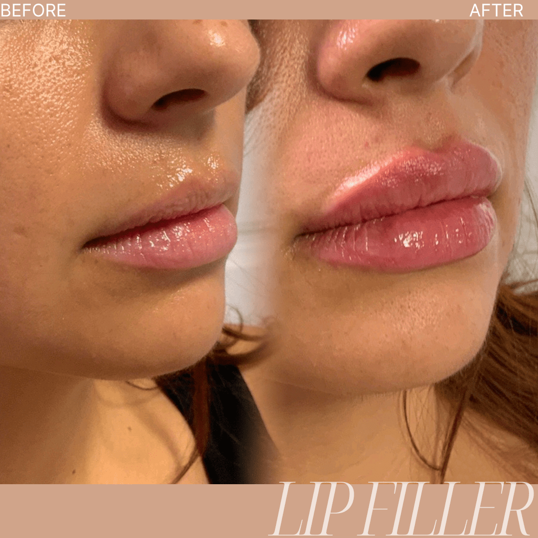 Before & After Med Spa Photos | Cactus Rose Aesthetics